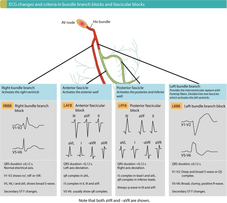 Understanding Your Borderline ECG: Causes, Concerns, and Next Steps ...