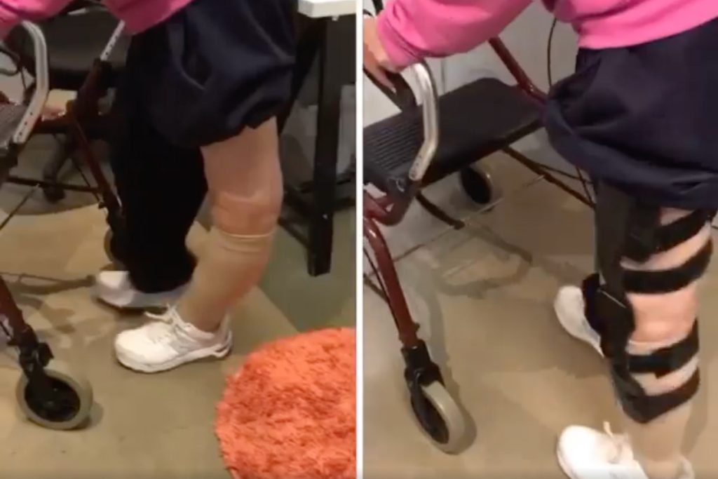 Hyperextension Knee Braces: Your Ultimate Guide to Prevention ...