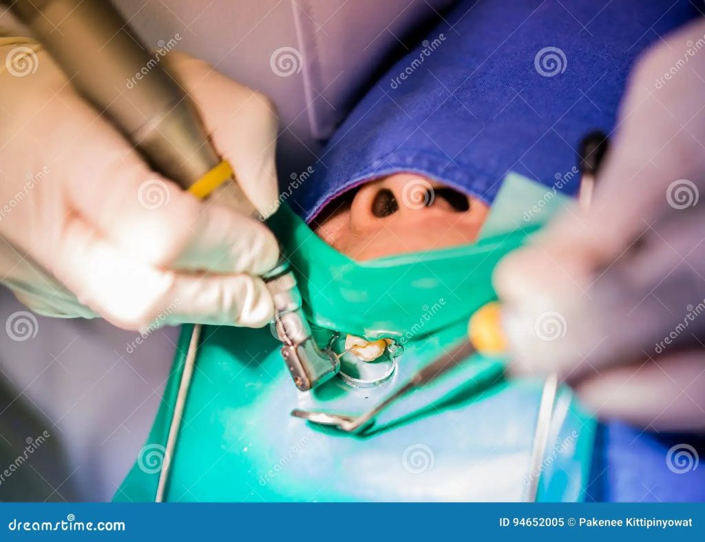 Root Canal Tooth Sensitive to Pressure? Causes, Solutions & When to ...