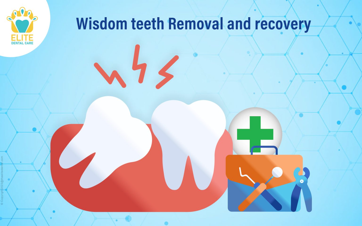 The Agony of Anesthesia-Free Wisdom Tooth Extraction: How Bad Is It ...