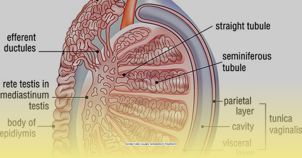 Scrotal Sebaceous Cysts: A Comprehensive Guide to Causes, Symptoms, and ...
