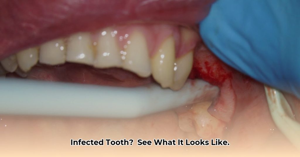 Infected Tooth Extraction Images: What to Look For & When to Seek Help ...