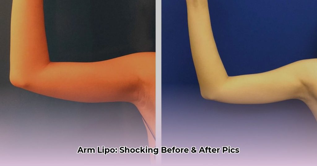 Arm Liposuction Before & After: Real Patient Photos & Results - Chaztin