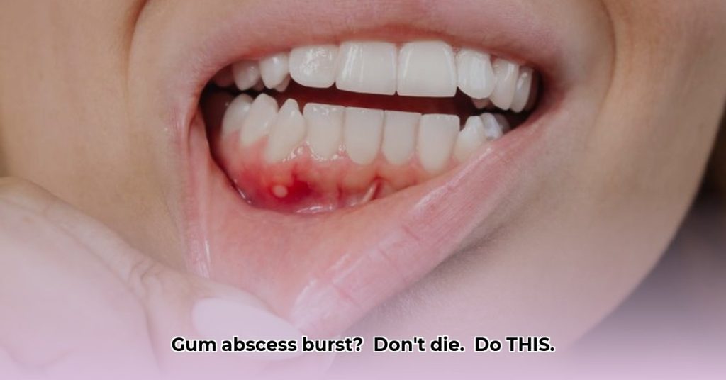 Can Popping a Gum Abscess Kill You? Dangers and What to Do - Chaztin