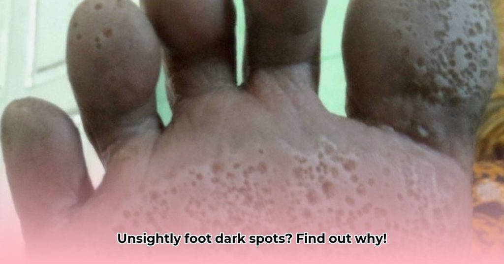 Dark Spots on Feet: Causes, Diagnosis & Treatment - Chaztin