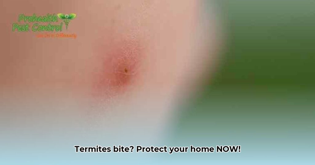 Do Termites Bite People? Prevent Home Damage Now - Chaztin