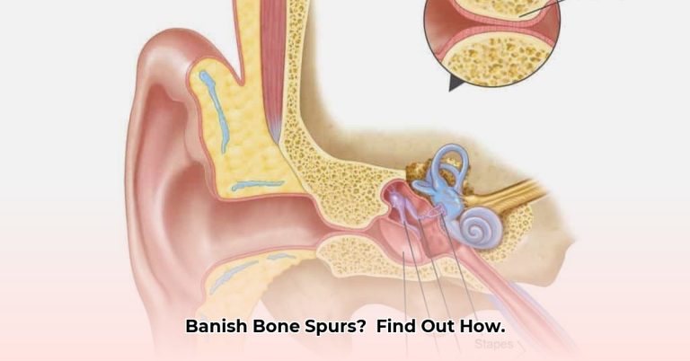 Exostectomy Surgery: Effective Bone Spur Removal - Chaztin