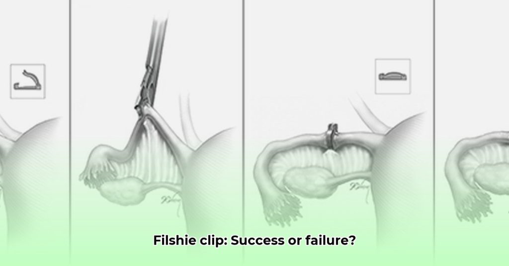Filshie Clip: Success Rates & Migration Risks - Chaztin